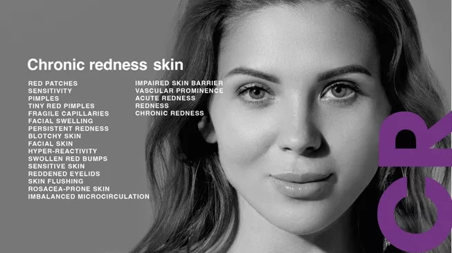 Skincare Products - Loud Skin Clinic Westhoughton, Bolton | Advanced ...